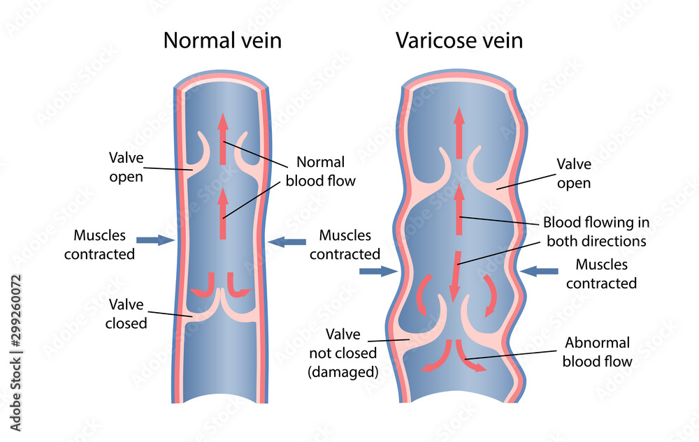 Venous Blood Flow