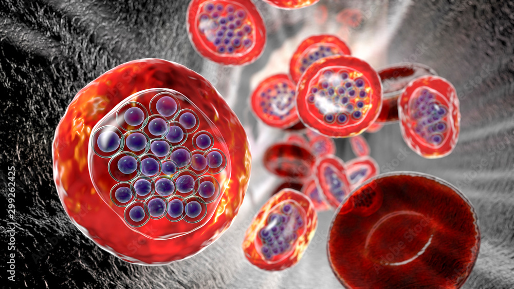 The malaria-infected red blood cells. 3D illustration showing parasite ...