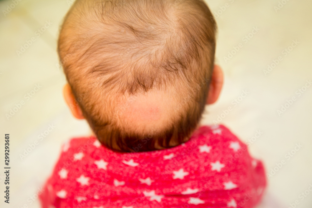 Bald spot on the back of the head of a small baby Stock Photo | Adobe Stock