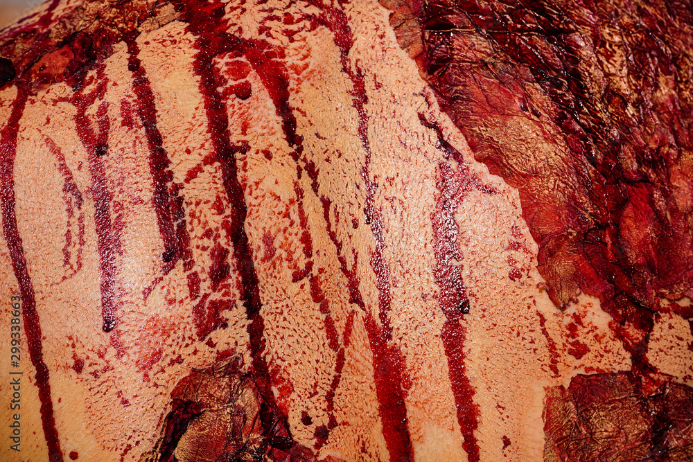 Traumatic injury patients with blood in the emergency room after the ...