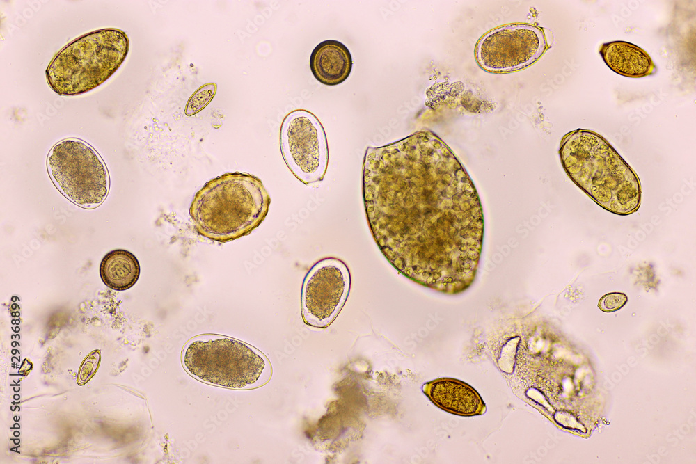 Parasites In Stool Microscope