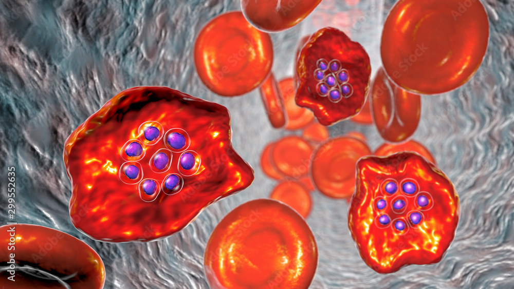 The malaria-infected red blood cell. 3D illustration showing malaria ...