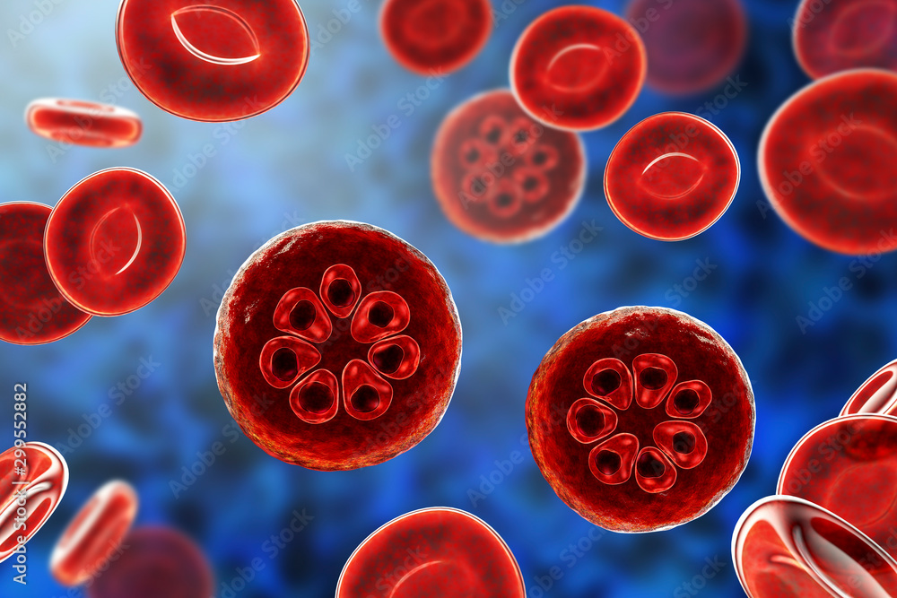 The malaria-infected red blood cell. 3D illustration showing parasite ...
