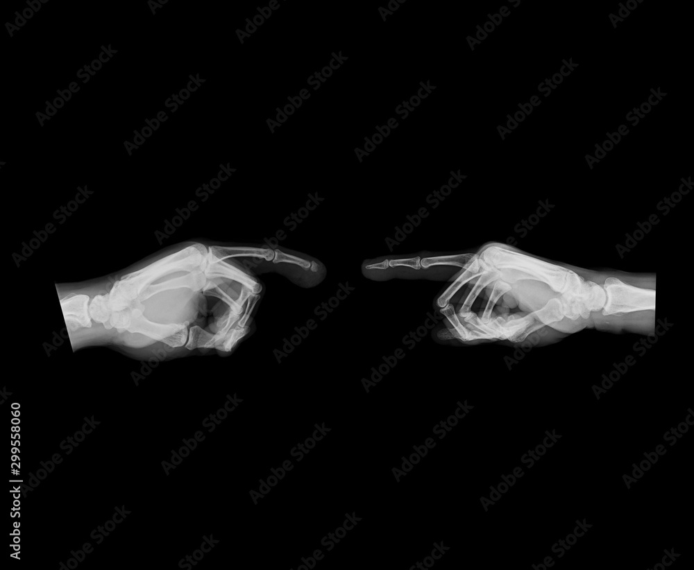 X-ray image of two hands using index finger pointing each other Stock ...