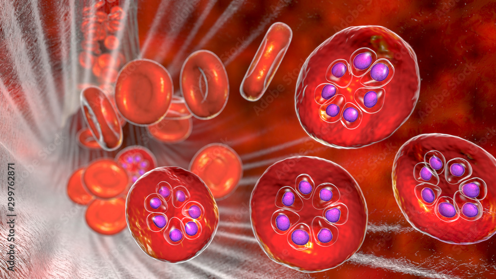 The malaria-infected red blood cell. 3D illustration showing parasite ...