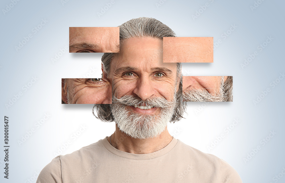 Portrait of mature man with skin problem on color background. Process ...
