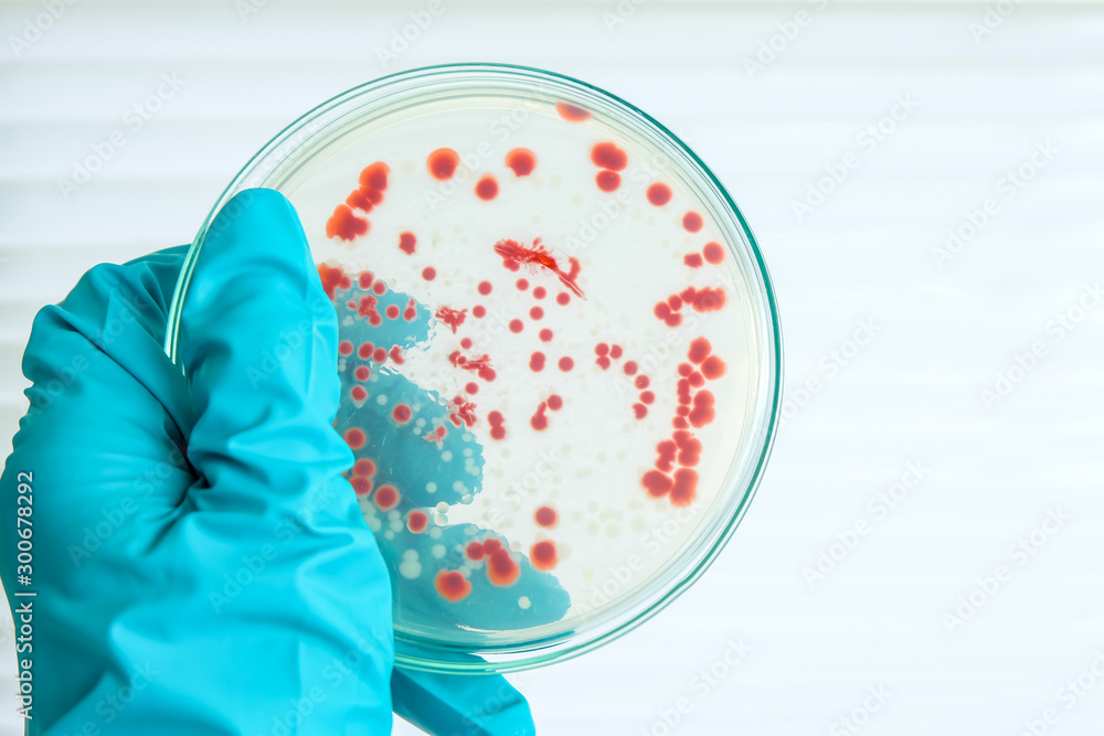 red colony of bacteria in laboratory Stock Photo | Adobe Stock