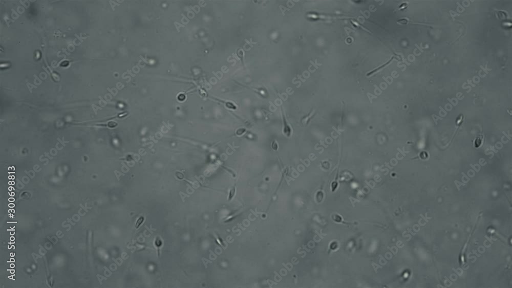 Sperm under the microscope, the movement of sperm cells in the seminal ...