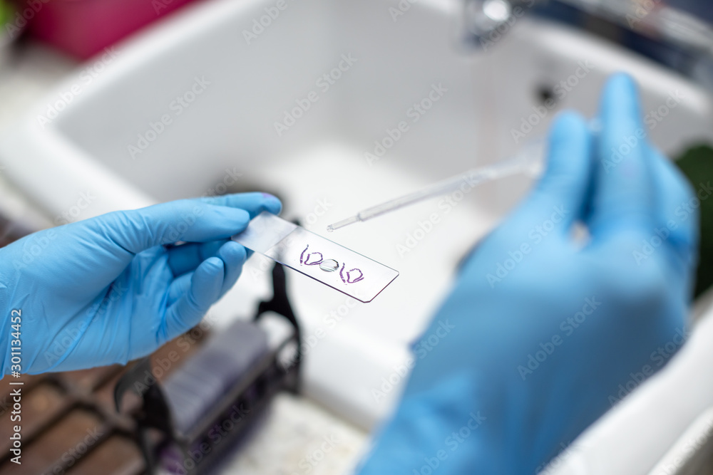 Pathological specimen preparation to detect abnormalities at the ...