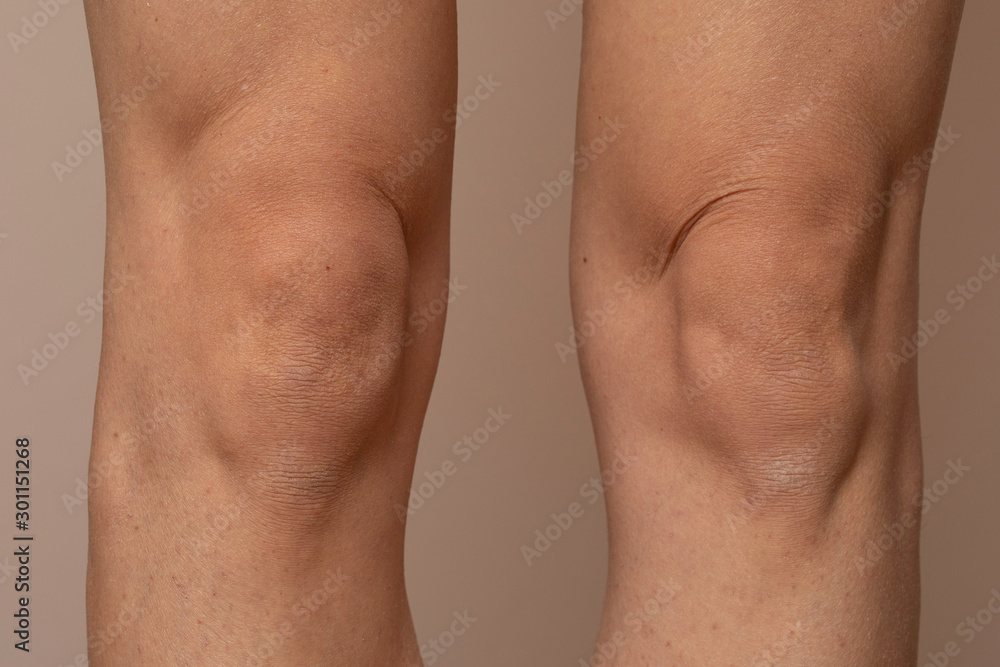 Human knees skin close up Stock Photo | Adobe Stock