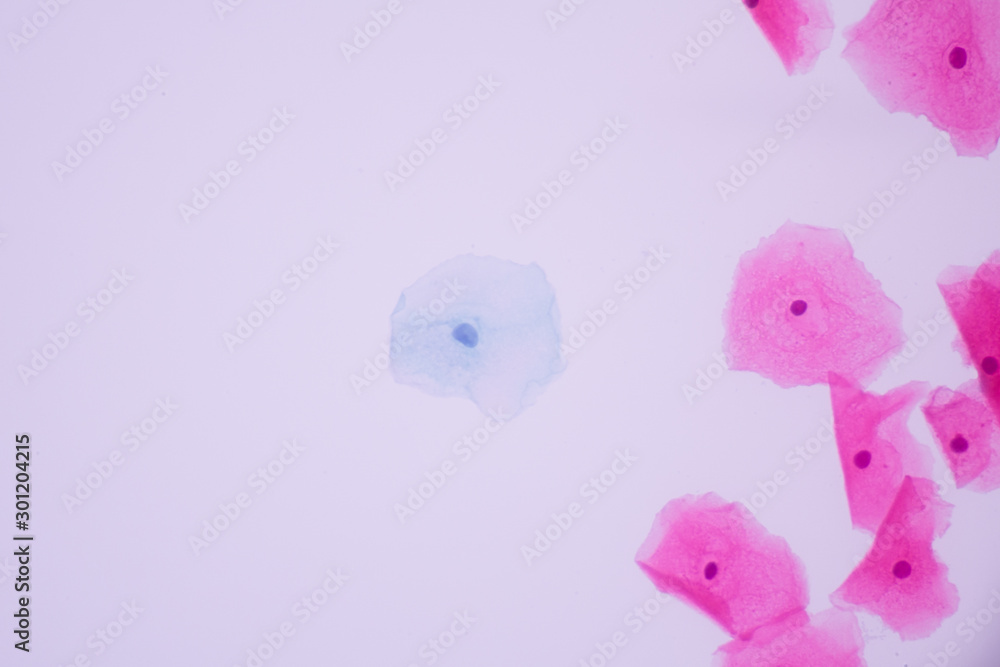 View in microscopic of normal human cervix cells.Squamous epithelium ...