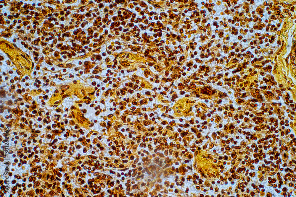 Reticular cell is a type of fibroblast. They are found in many tissues ...