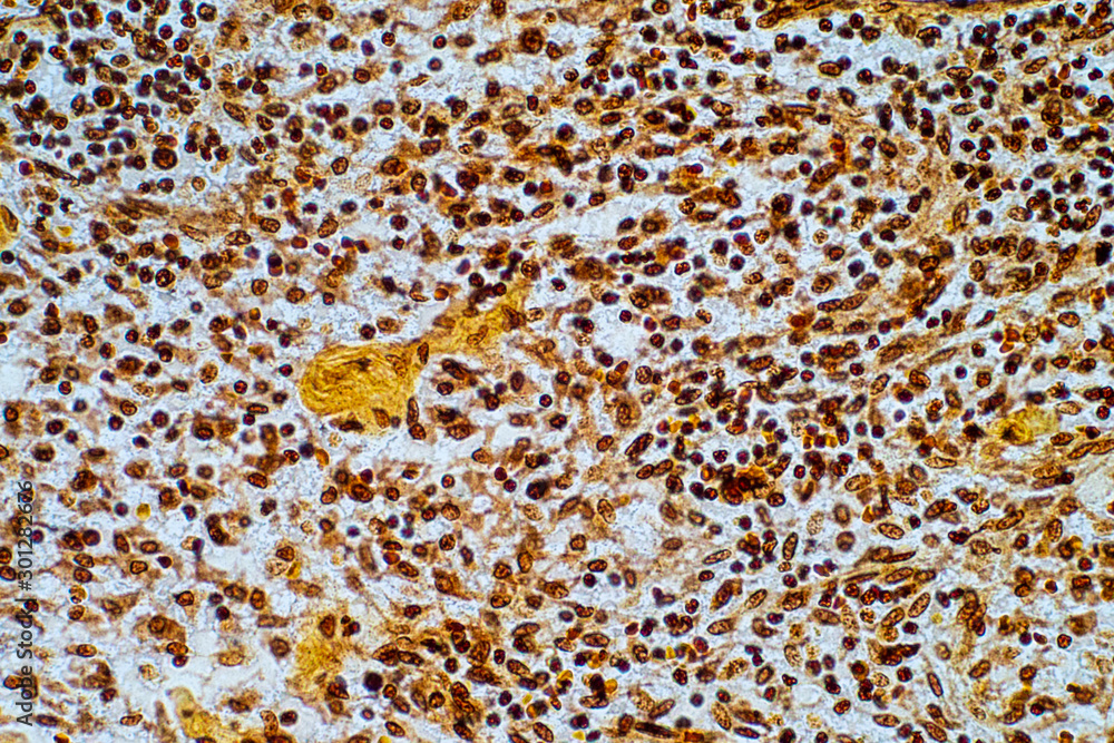 Reticular cell is a type of fibroblast. They are found in many tissues ...