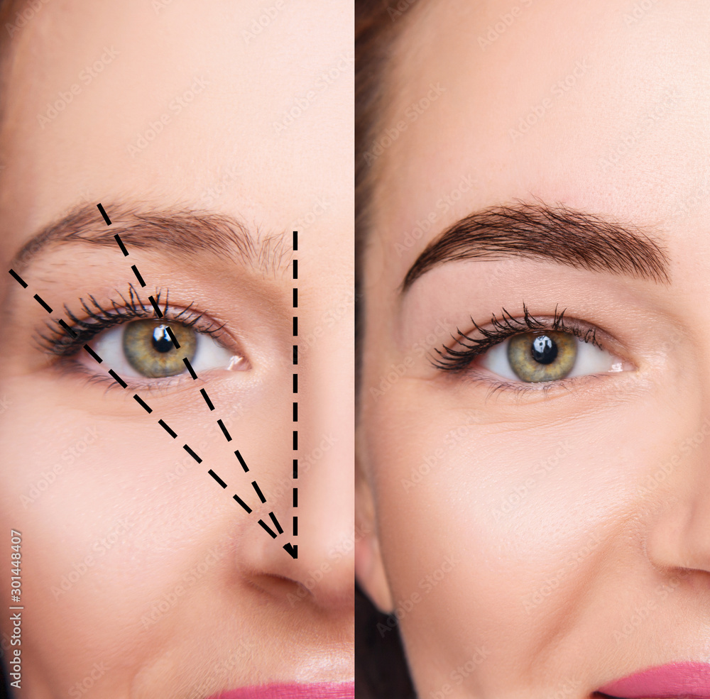 Young woman with dotted lines before and after eyebrows correction ...
