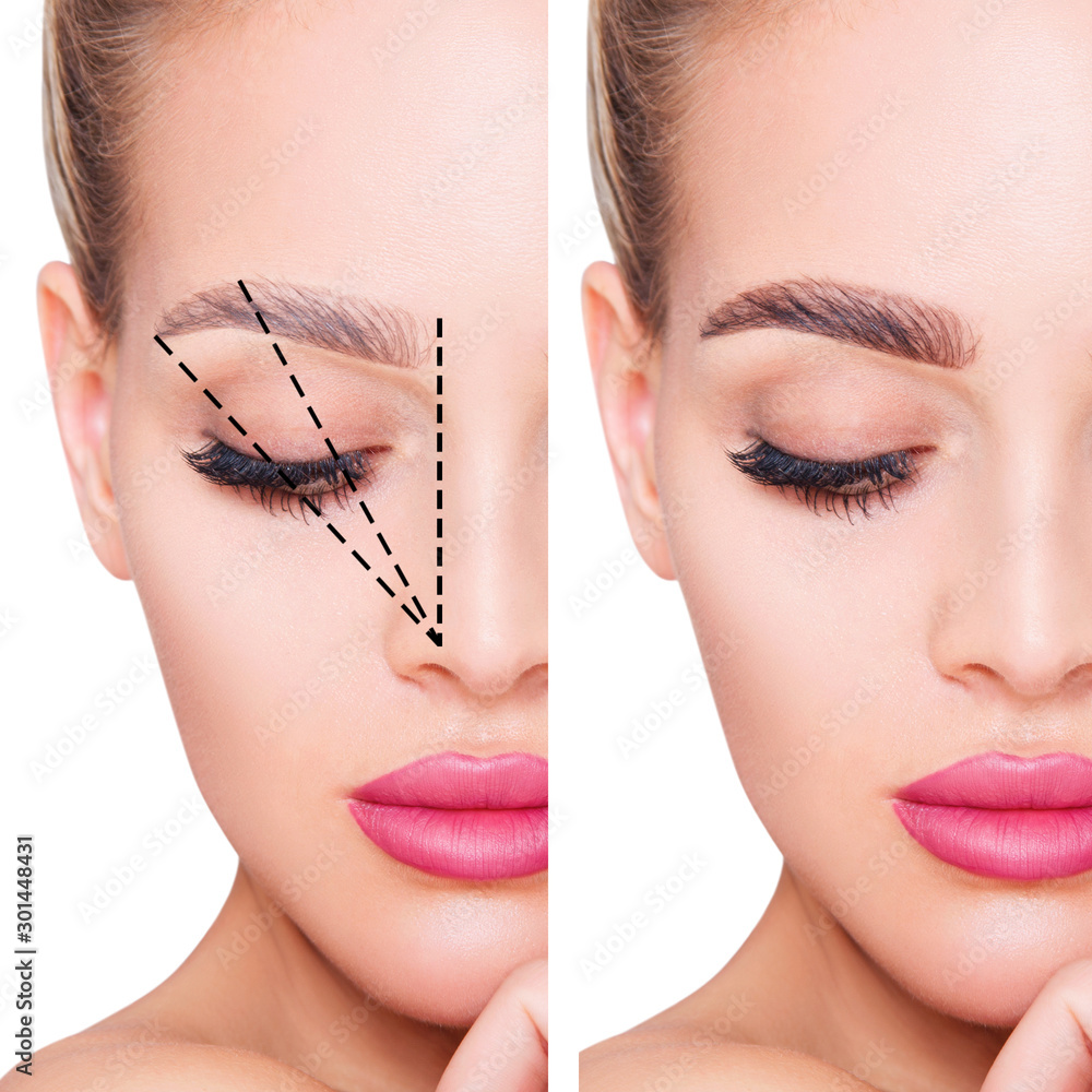 Young woman with dotted lines before and after eyebrows correction ...