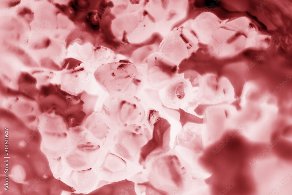 cancer cells under the microscope. Tissues affected by cancer cells ...