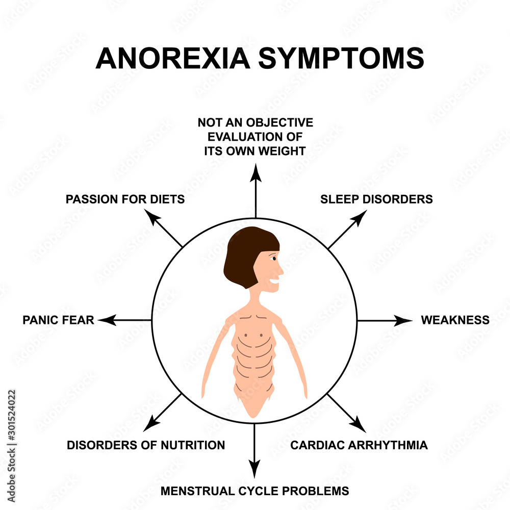 Anorexia symptoms. Slim physique with anorexia. Infographics. Vector ...