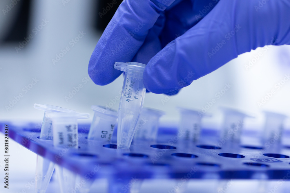 Polymerase Chain Reaction (PCR) and Agarose gel electrophoresis is a ...