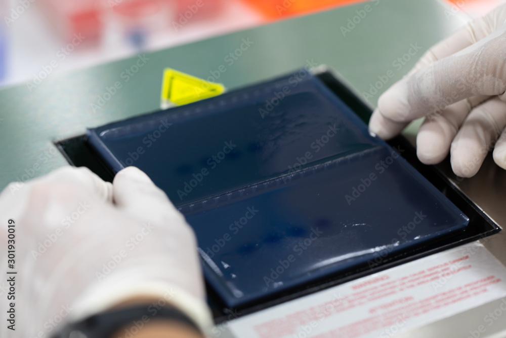 Polymerase Chain Reaction (PCR) and Agarose gel electrophoresis is a ...