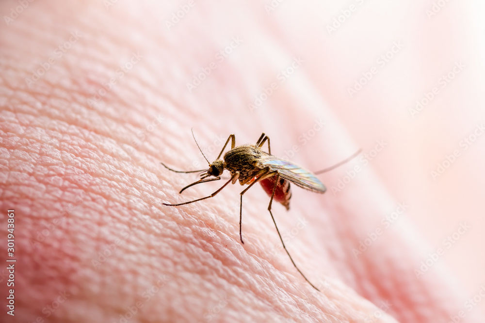 Dangerous Zika Infected Mosquito Skin Bite. Leishmaniasis, Encephalitis ...
