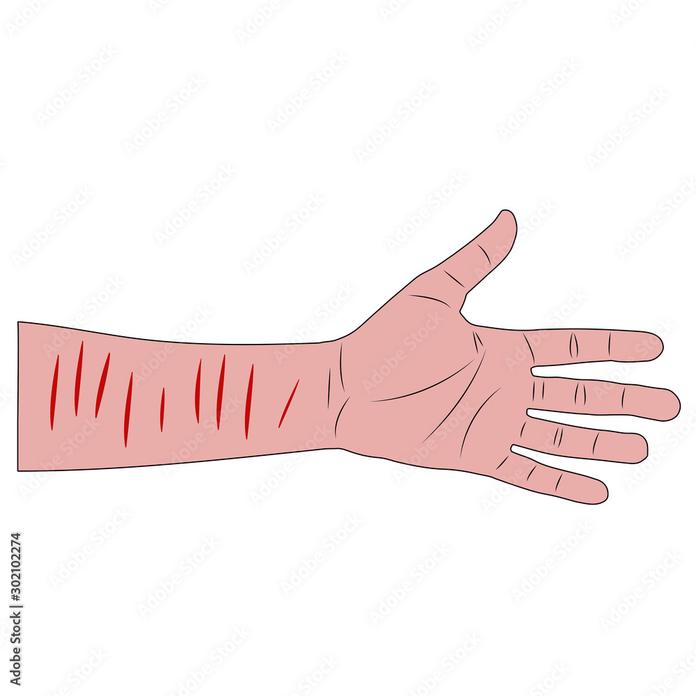 male hand with bloody cuts on the wrist after suicide attempt. isolated ...