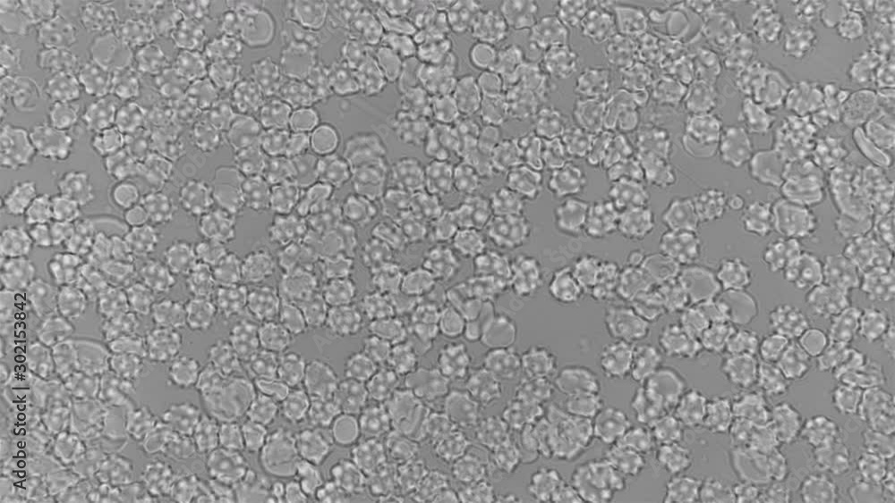 Video „Blood under a microscope, the movement of spur-shaped red blood ...