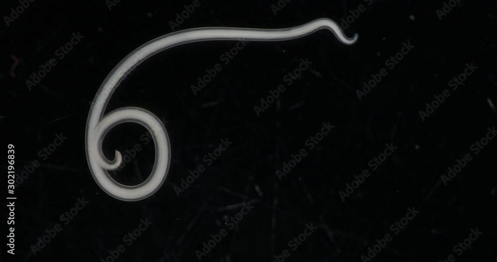 Study Ascarid nematode of the phylum Nematoda, it is the most common ...