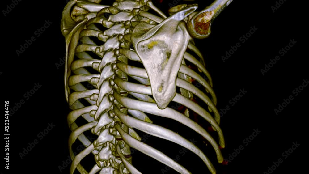A 3D CT scan of the bones of a male torso, realistic 3D reconstruction ...