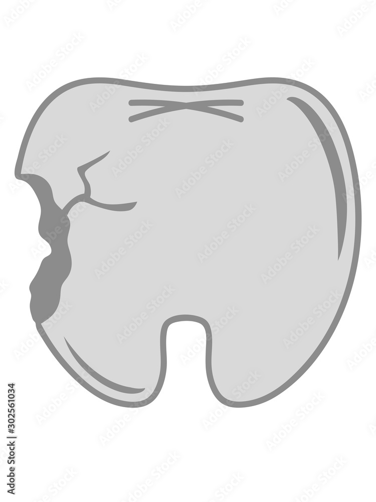 karies loch im zahn krank kaputt baby zähnchen niedlich klein milchzahn ...