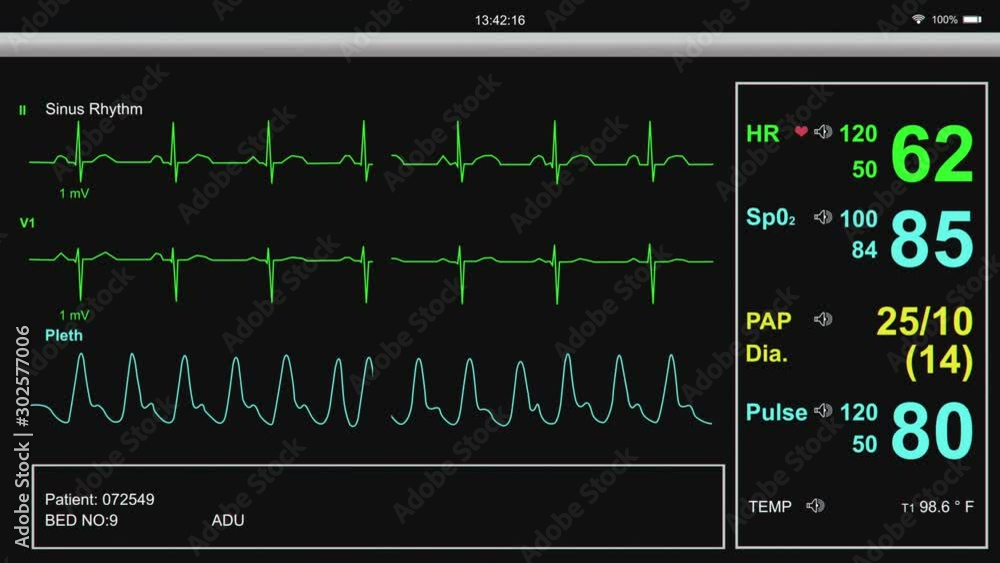 EKG Patient Heart Monitor Screen with Vital Signs Stock Video | Adobe Stock