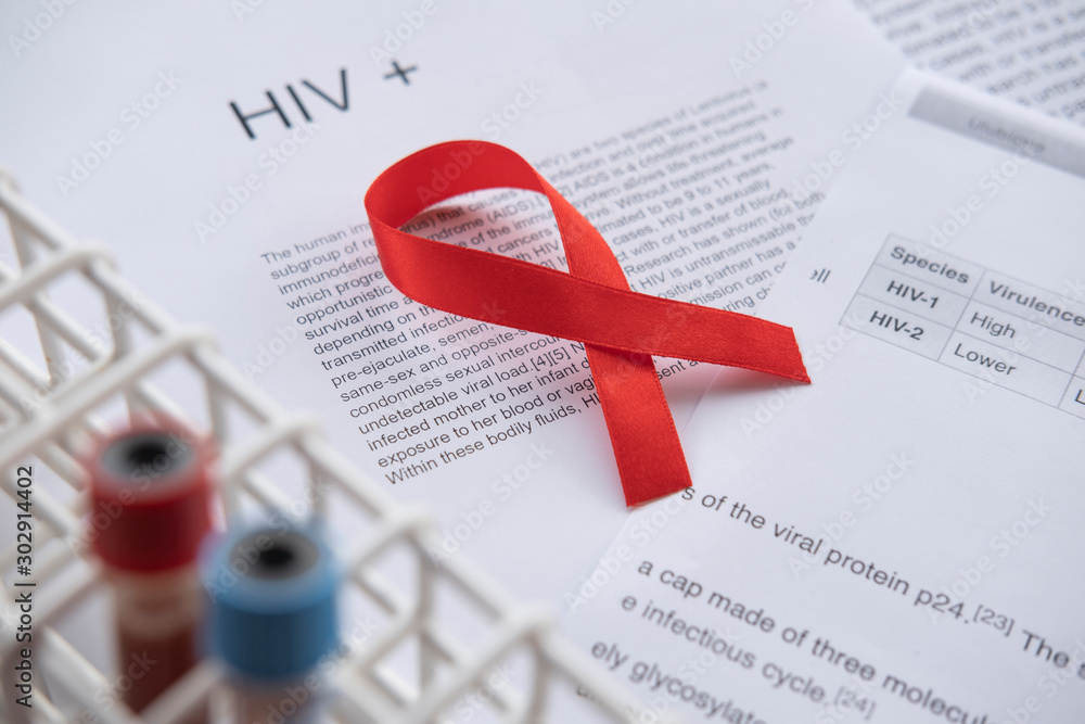 Red ribbon as a sign of HIV in laboratory scenery. Medical life. Stock ...