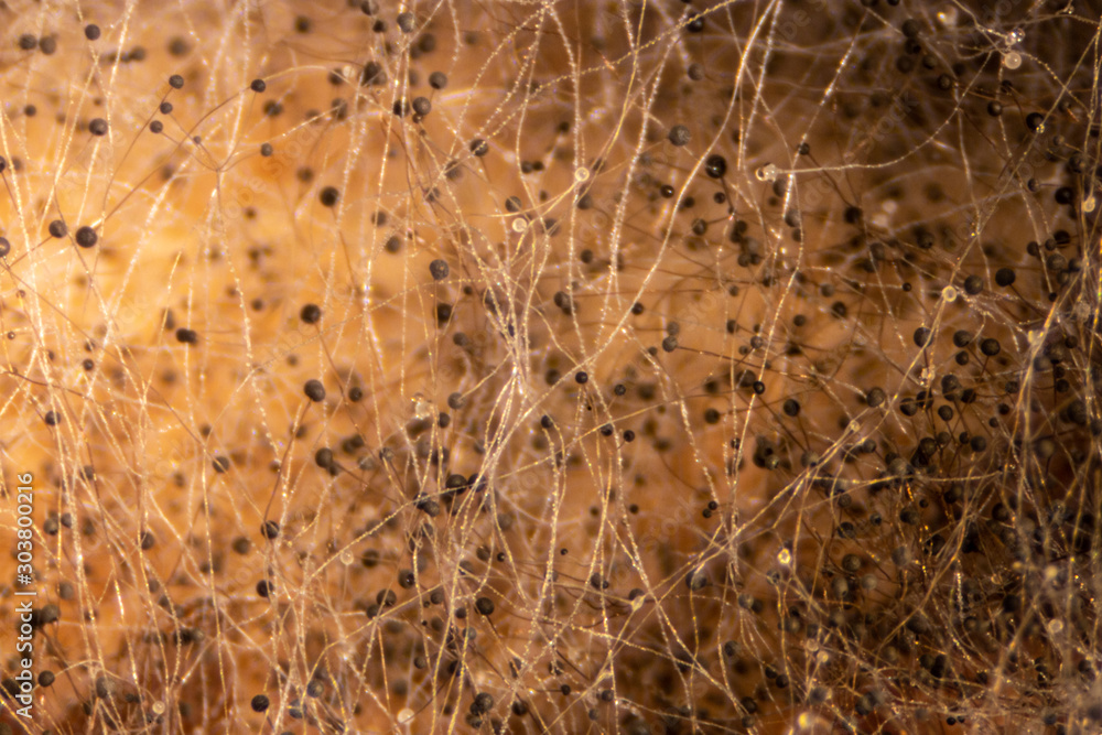 Rhizopus (bread mold) is a genus of common saprophytic fungi,Rhizopus ...