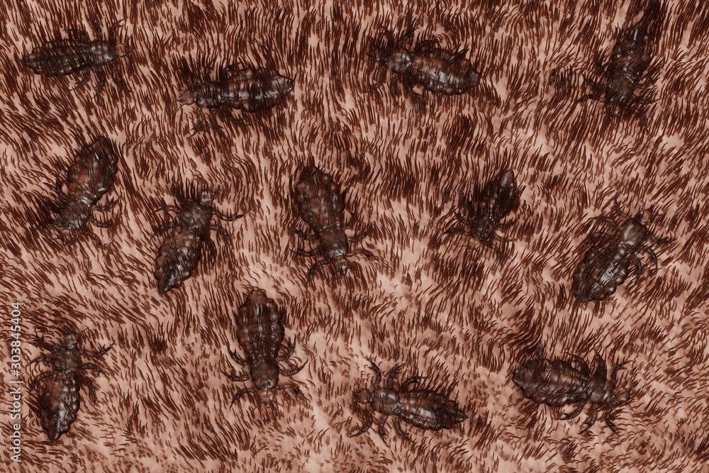 Realistic 3d Render of Head Lice Stock Illustration | Adobe Stock
