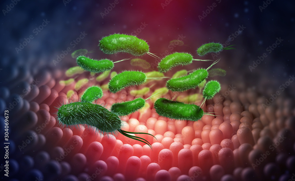 Bowel infection, upset stomach, germs and viruses in body. Intestinal ...