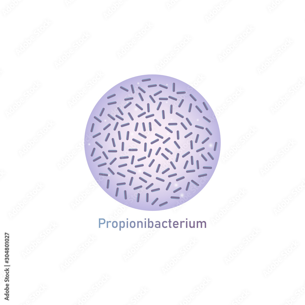 Propionibacterium