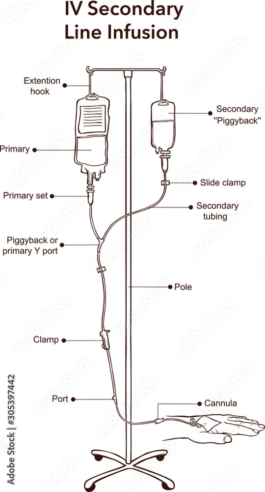 What Are The Differences Between Primary And Secondary IV, 60% OFF