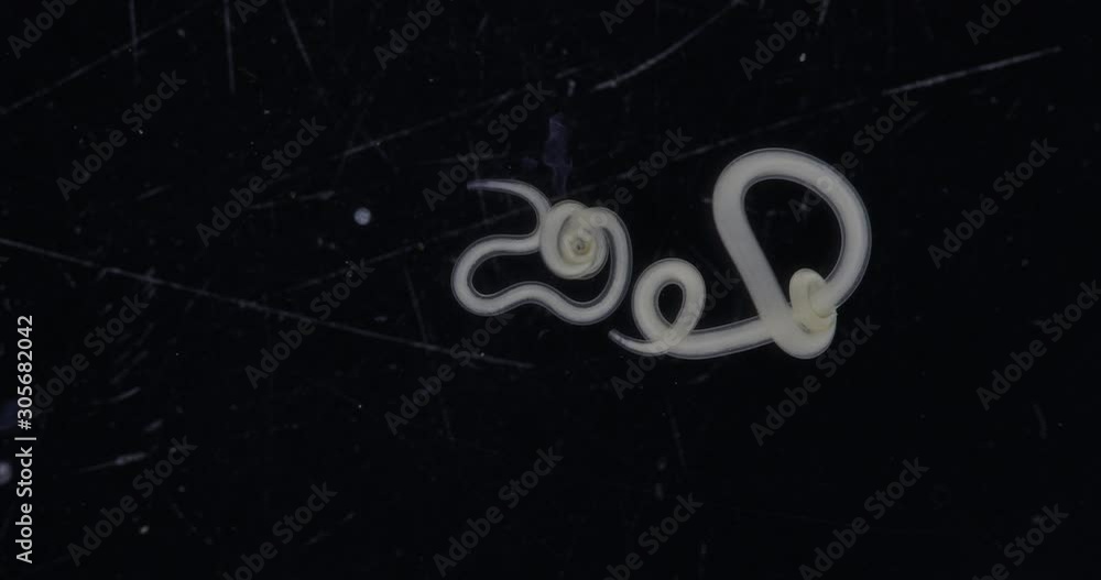 Study Ascarid nematode of the phylum Nematoda, it is the most common ...