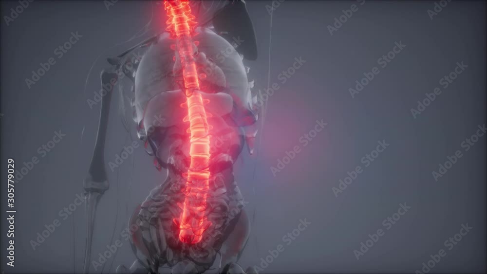 backache in backbone. science anatomy scan of human spine bones glowing ...