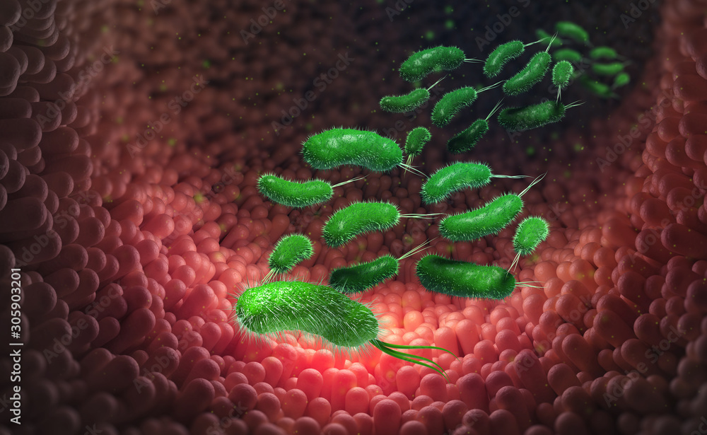 Escherichia coli, germs and viruses in body. Bowel infection, upset ...