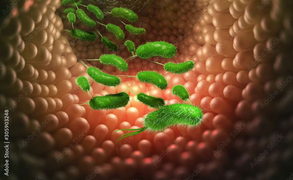 Escherichia coli, germs and viruses in body. Bowel infection, upset ...