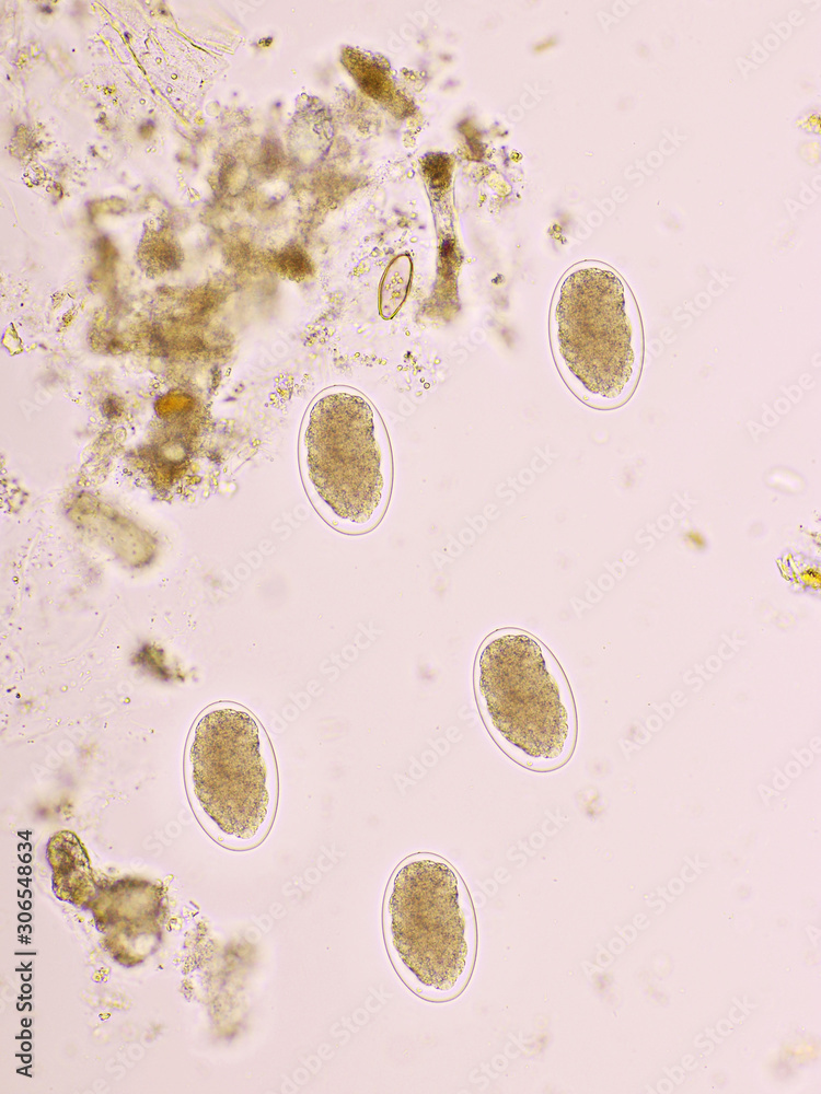 Human Hookworm Egg