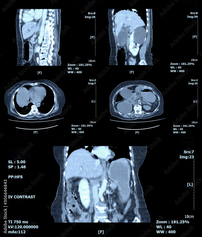 ct scan abdomen and body Stock Photo | Adobe Stock