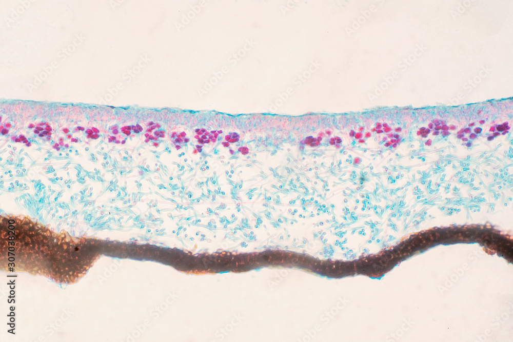 Lichen, Fungus, cross section slide under the microscope view. Stock ...
