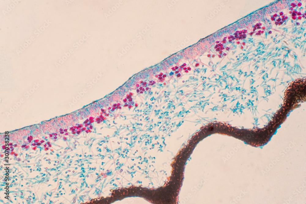 Lichen, Fungus, cross section slide under the microscope view. Stock ...