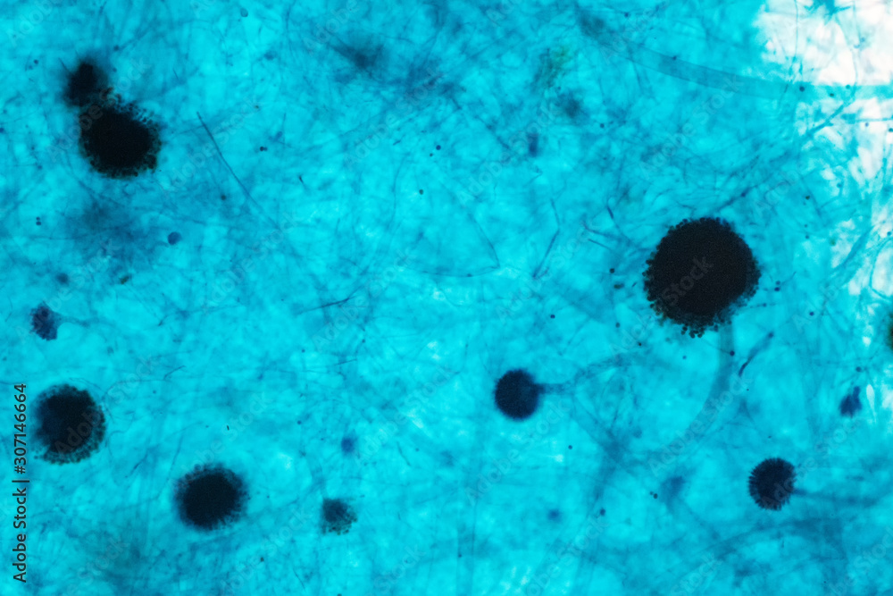 Rhizopus bread mold under the microscope. Stock Photo | Adobe Stock