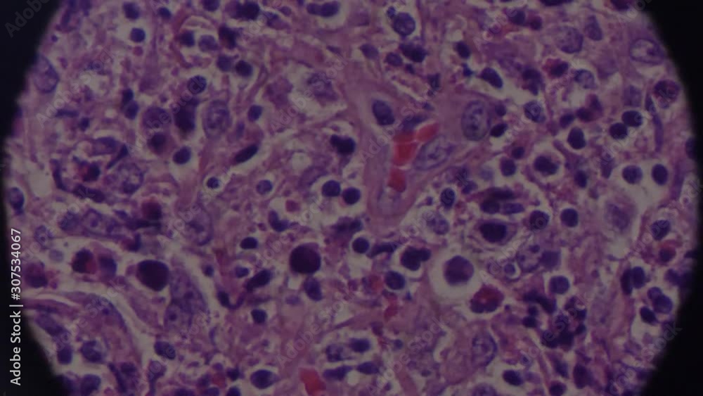 cells seen through a microscope 4k Stock Video | Adobe Stock