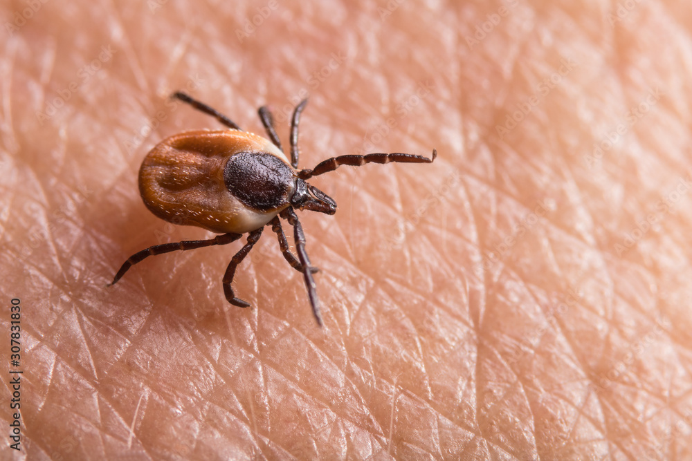 Female castor bean tick crawling on pink human skin. Ixodes ricinus ...
