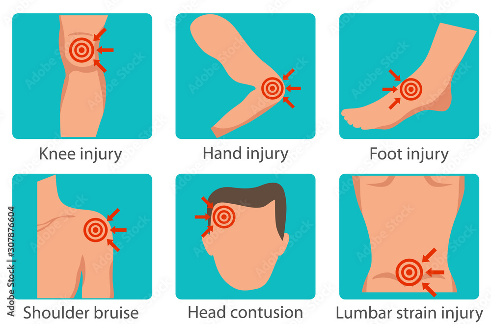 Human body parts physical injury flat set. Physical injuries poster ...