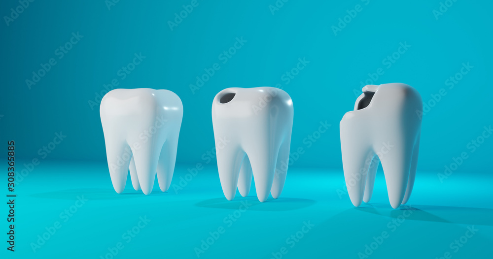 Ilustrace „Image of three different teeth: a healthy tooth, teeth with ...