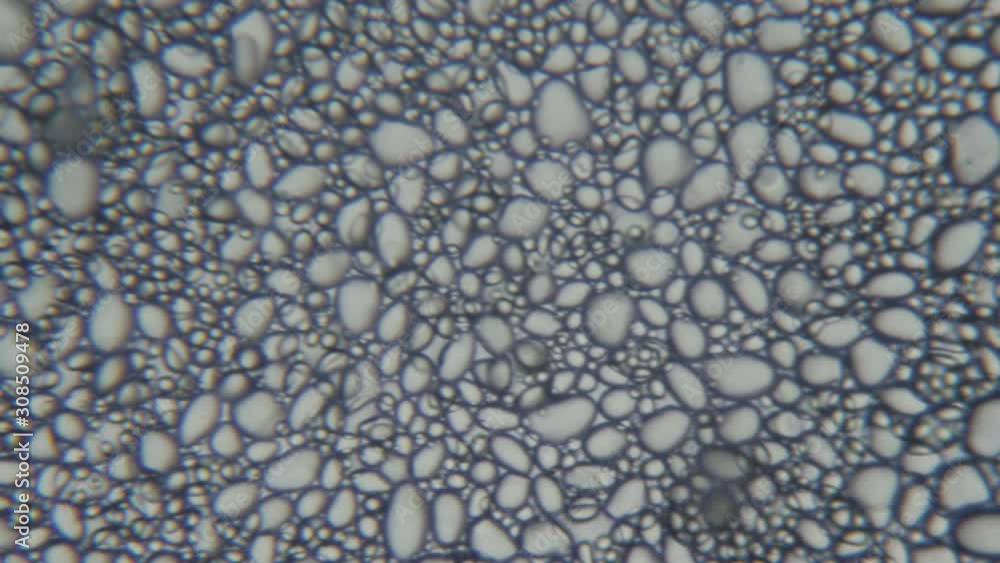 Highly magnified starch granules from a potato. Close up. Potato starch ...